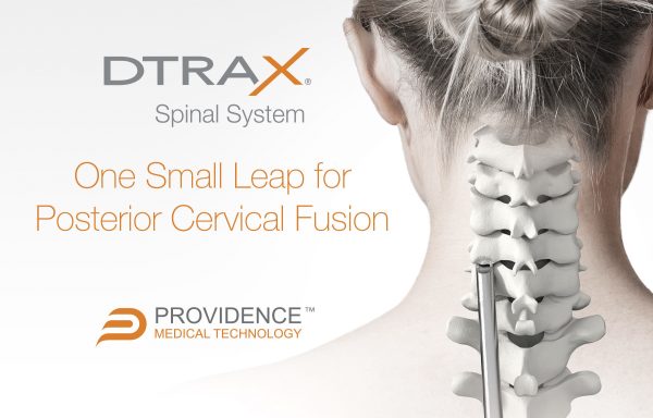 Providence Medical Technology Secures $25 Million In Equity Financing ...
